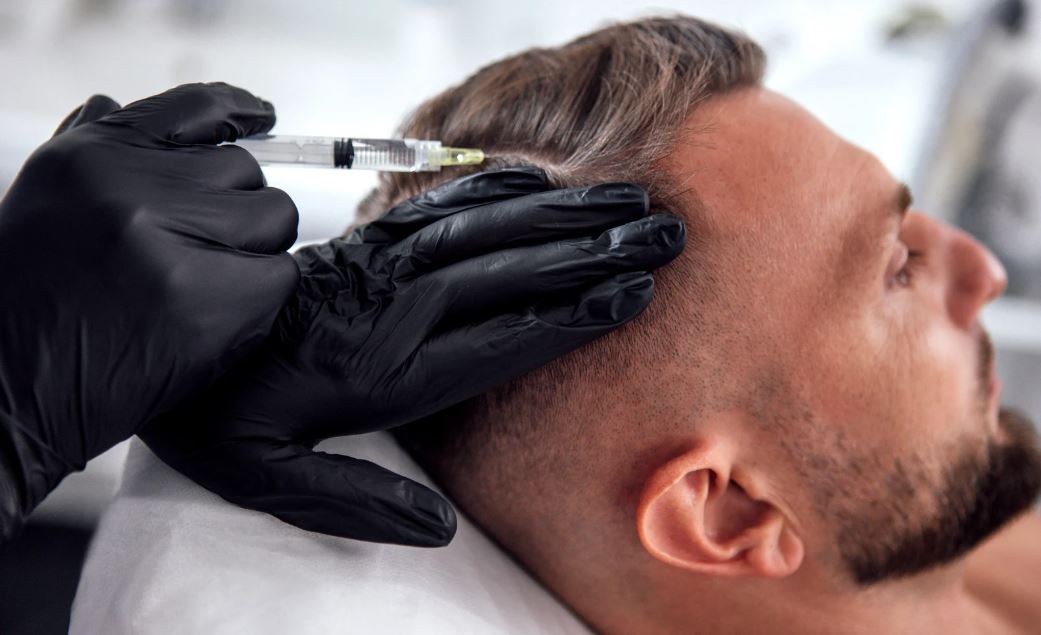 Does PRP Work for Hair Loss? How It Works and Lasts Over Time